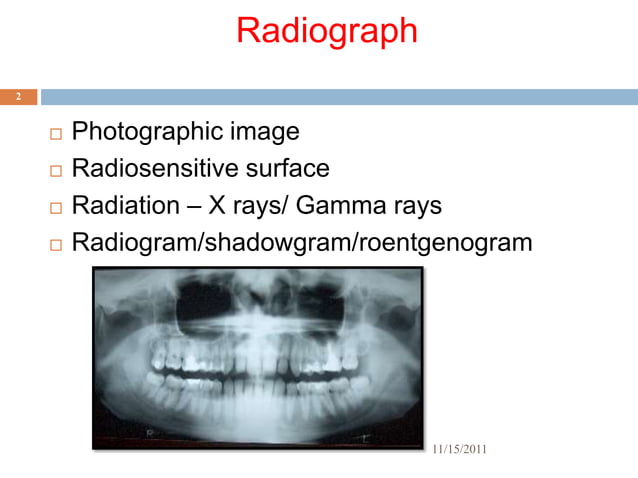 Radiographic interpretation | PPTX