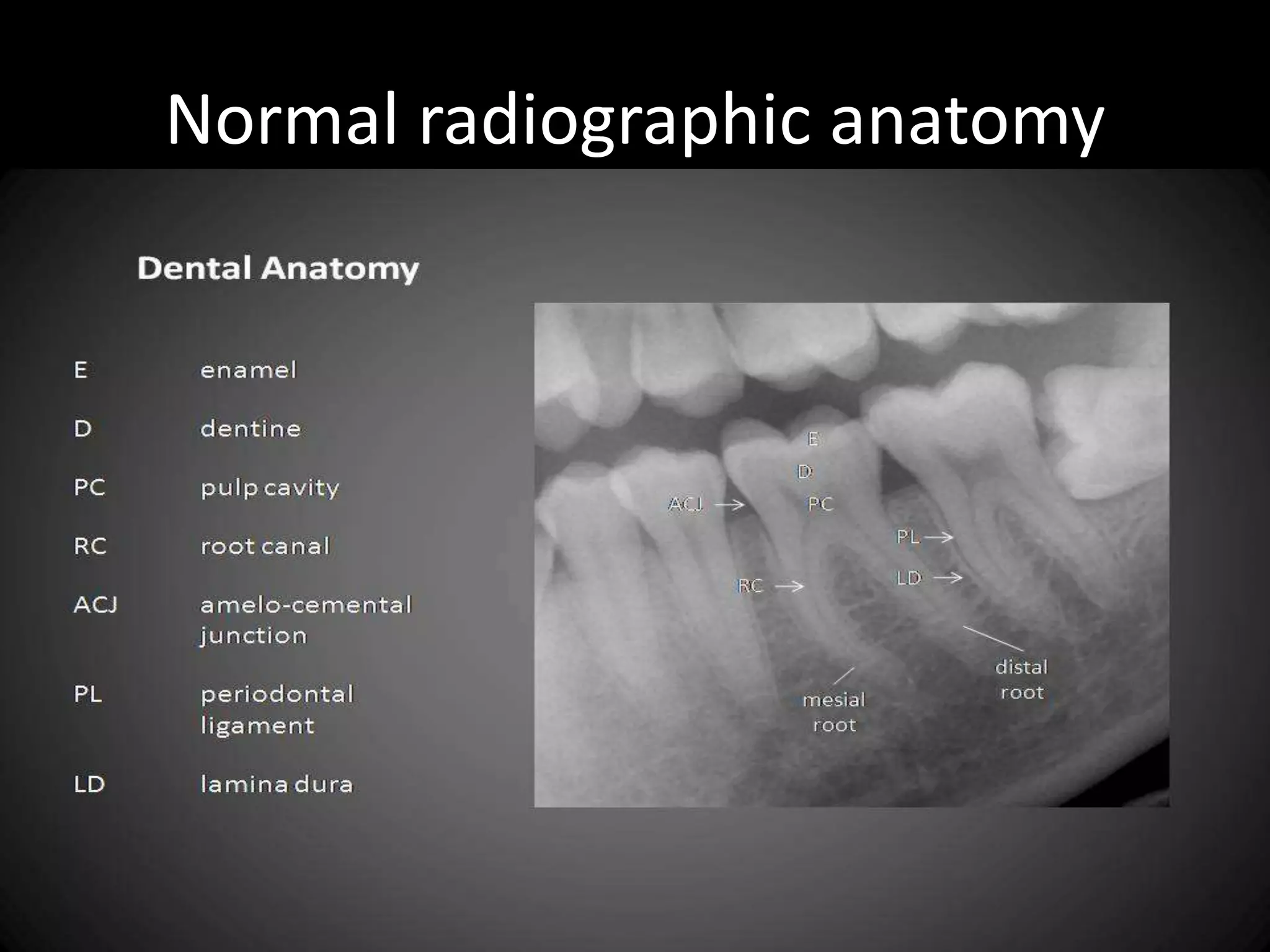 Radiographic interpretation | PPTX