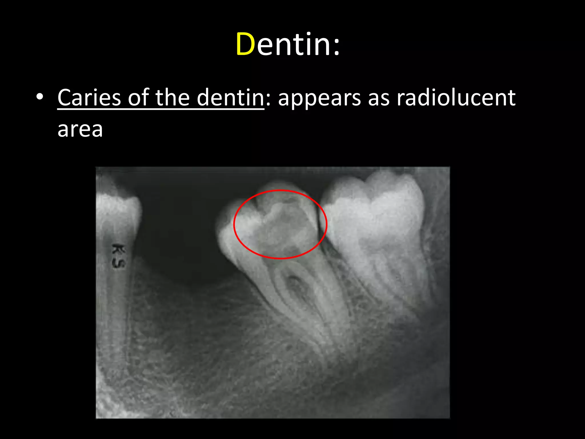 Radiographic interpretation | PPTX