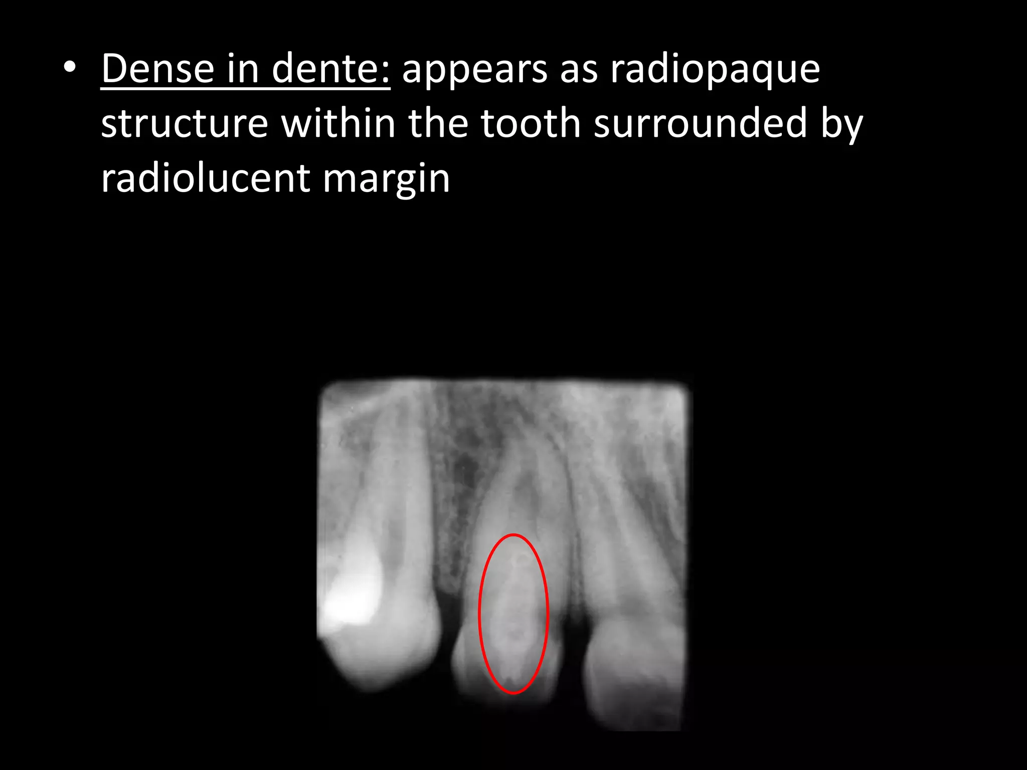 Radiographic interpretation | PPTX