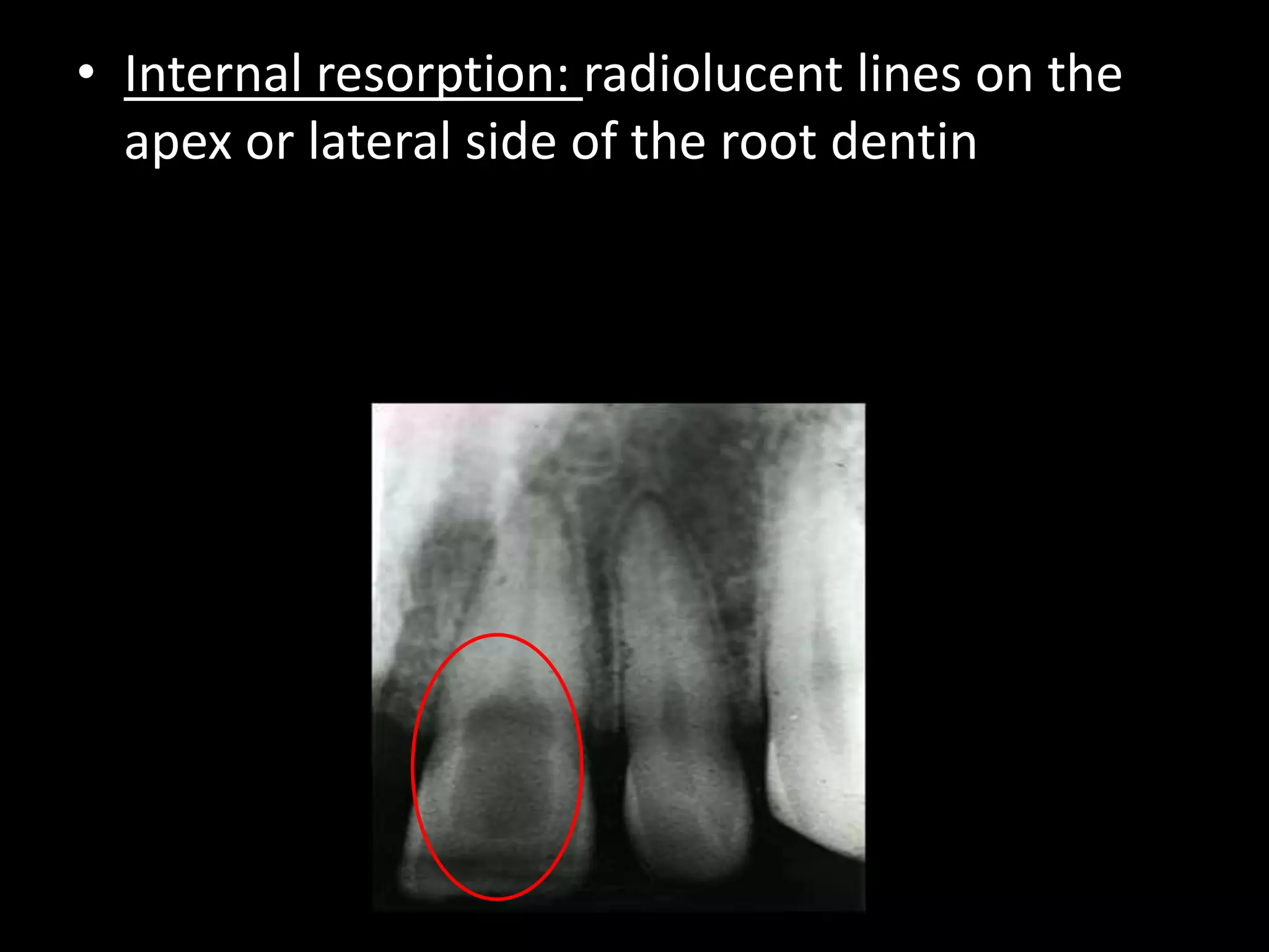 Radiographic interpretation | PPTX