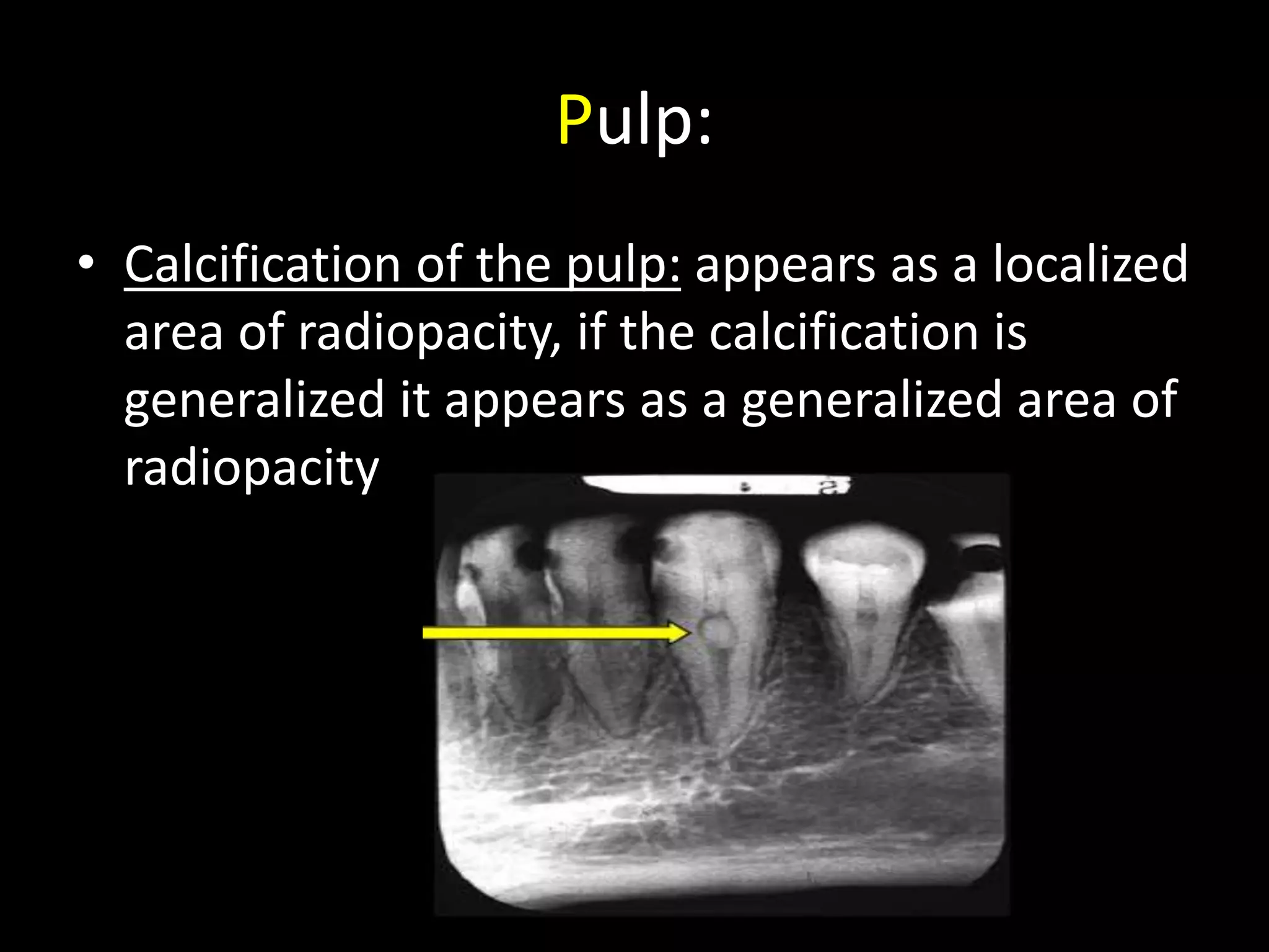 Radiographic interpretation | PPTX