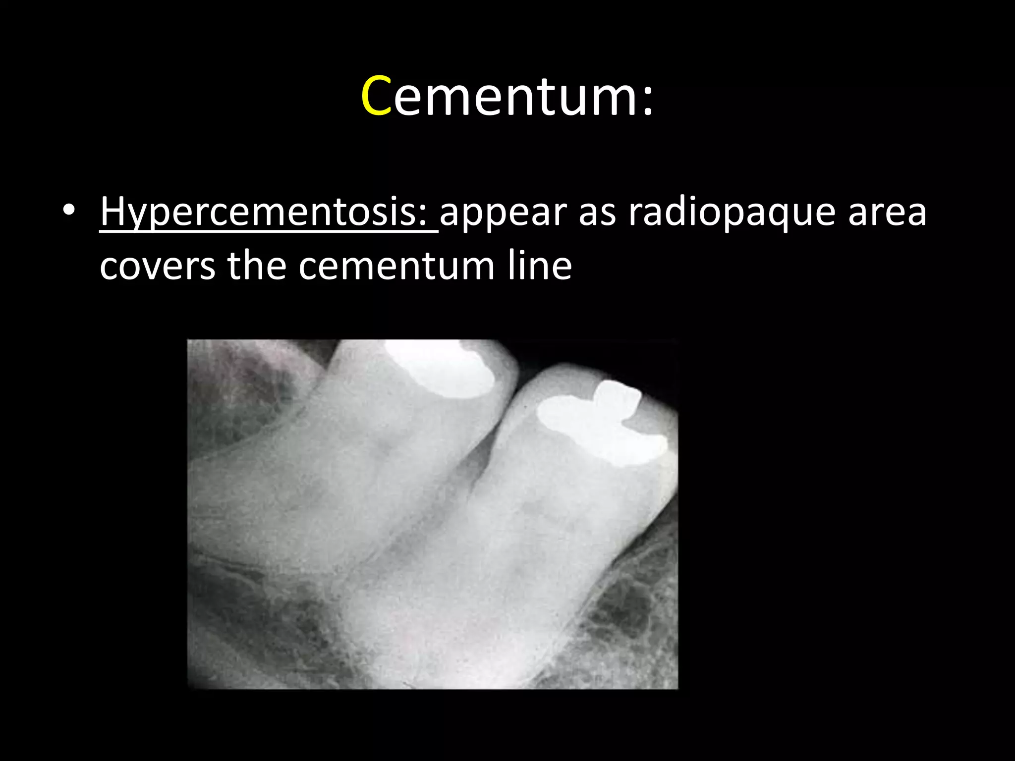 Radiographic interpretation | PPTX