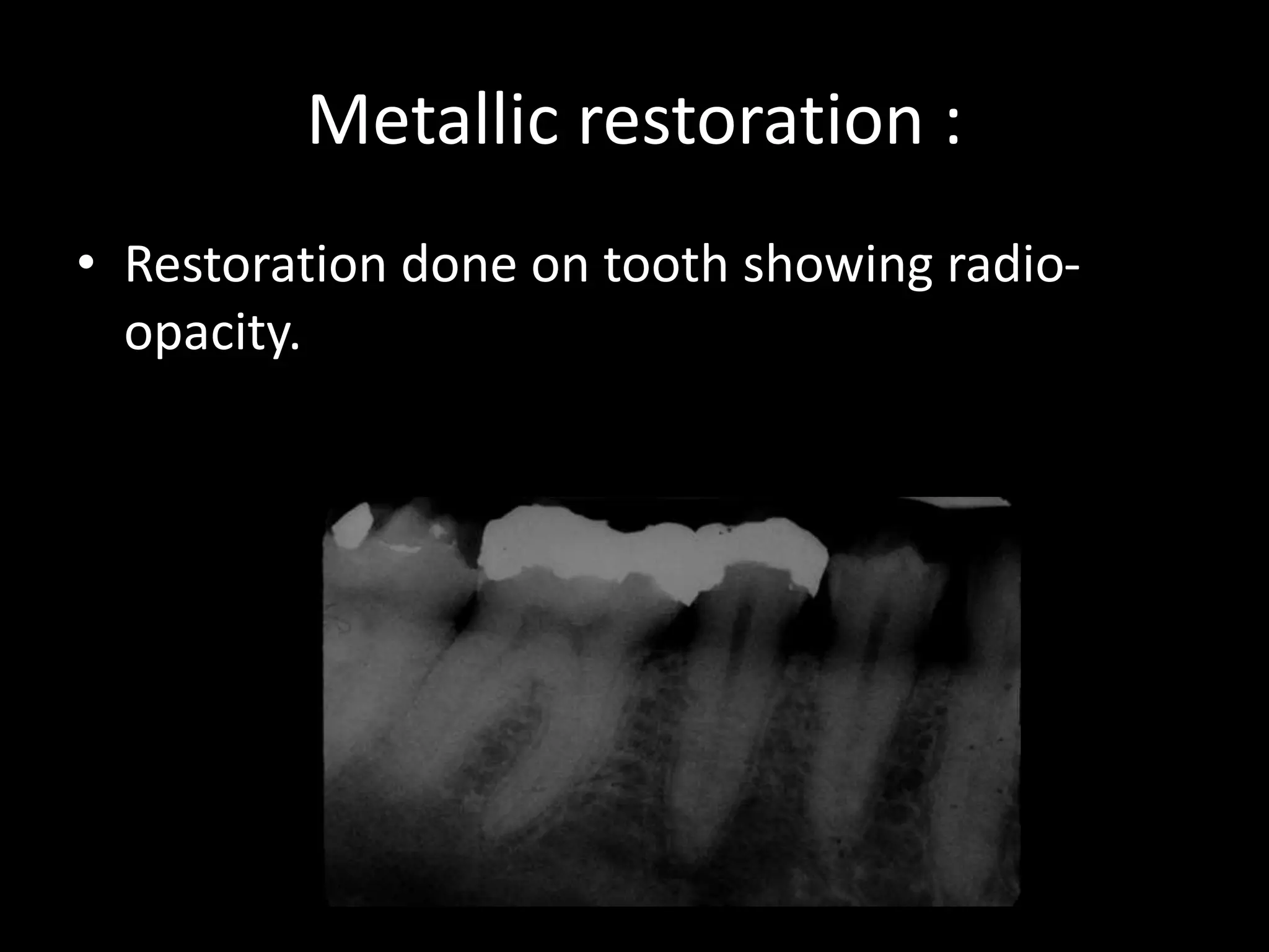 Radiographic interpretation | PPTX