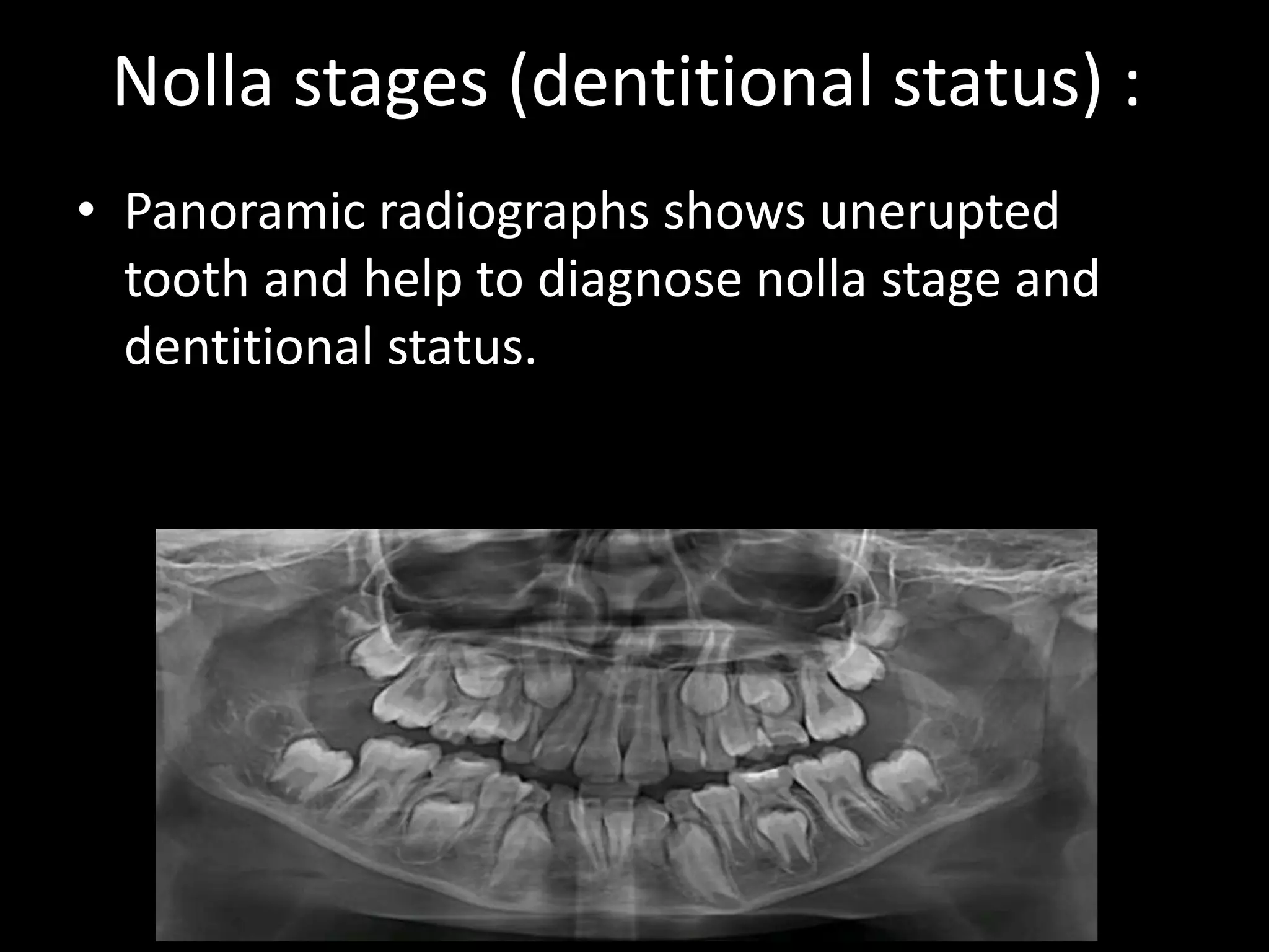 Radiographic interpretation | PPTX