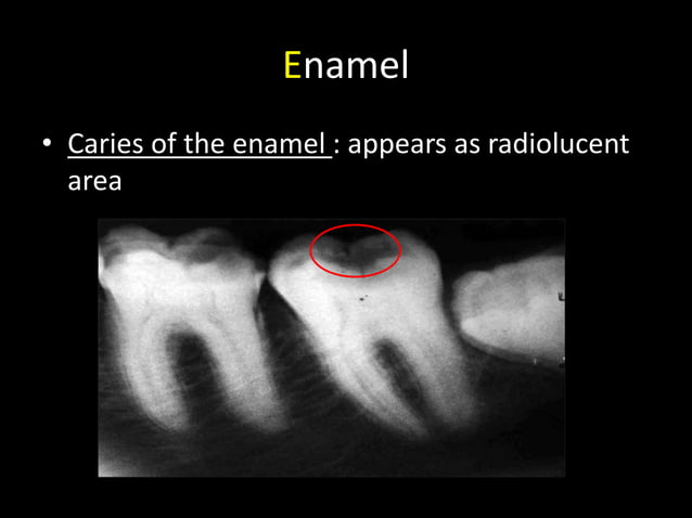 Radiographic interpretation | PPTX