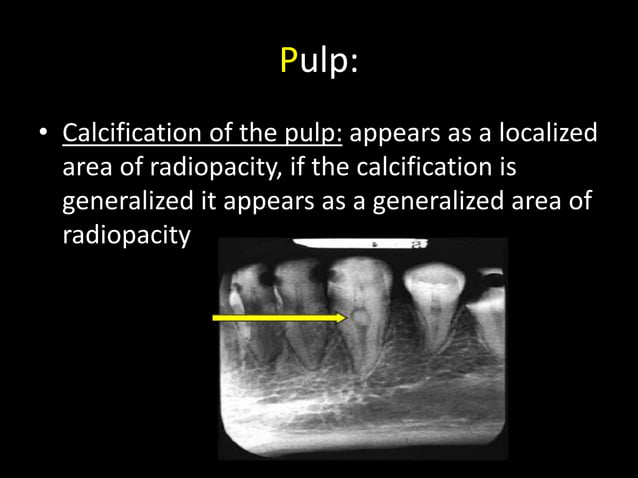 Radiographic interpretation | PPTX