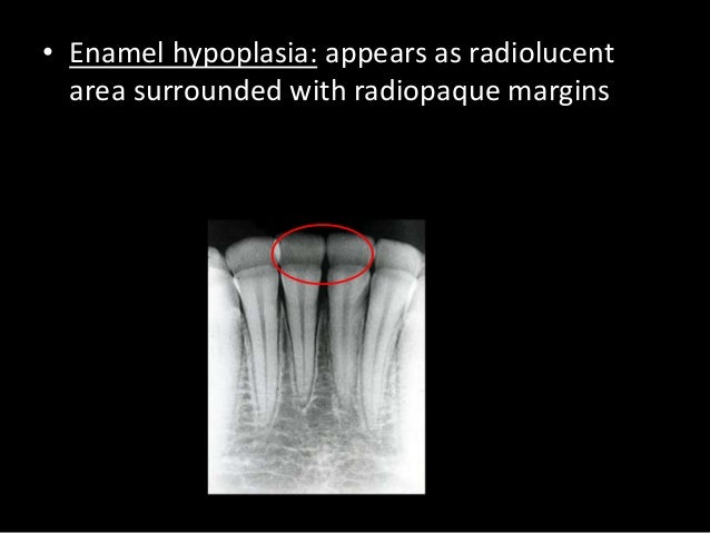 Radiographic interpretation