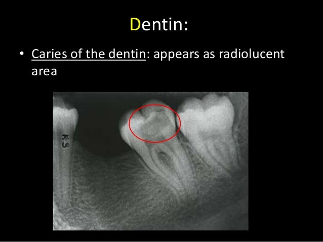 Radiographic interpretation