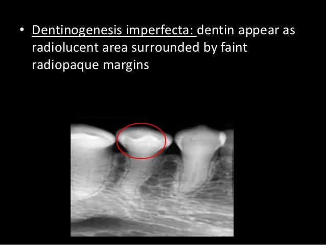 Radiographic interpretation