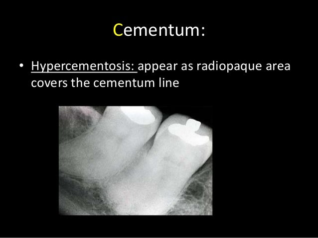 Radiographic interpretation