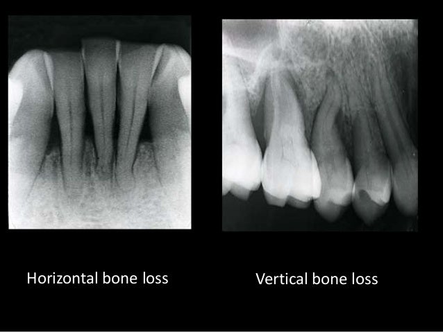 Radiographic interpretation