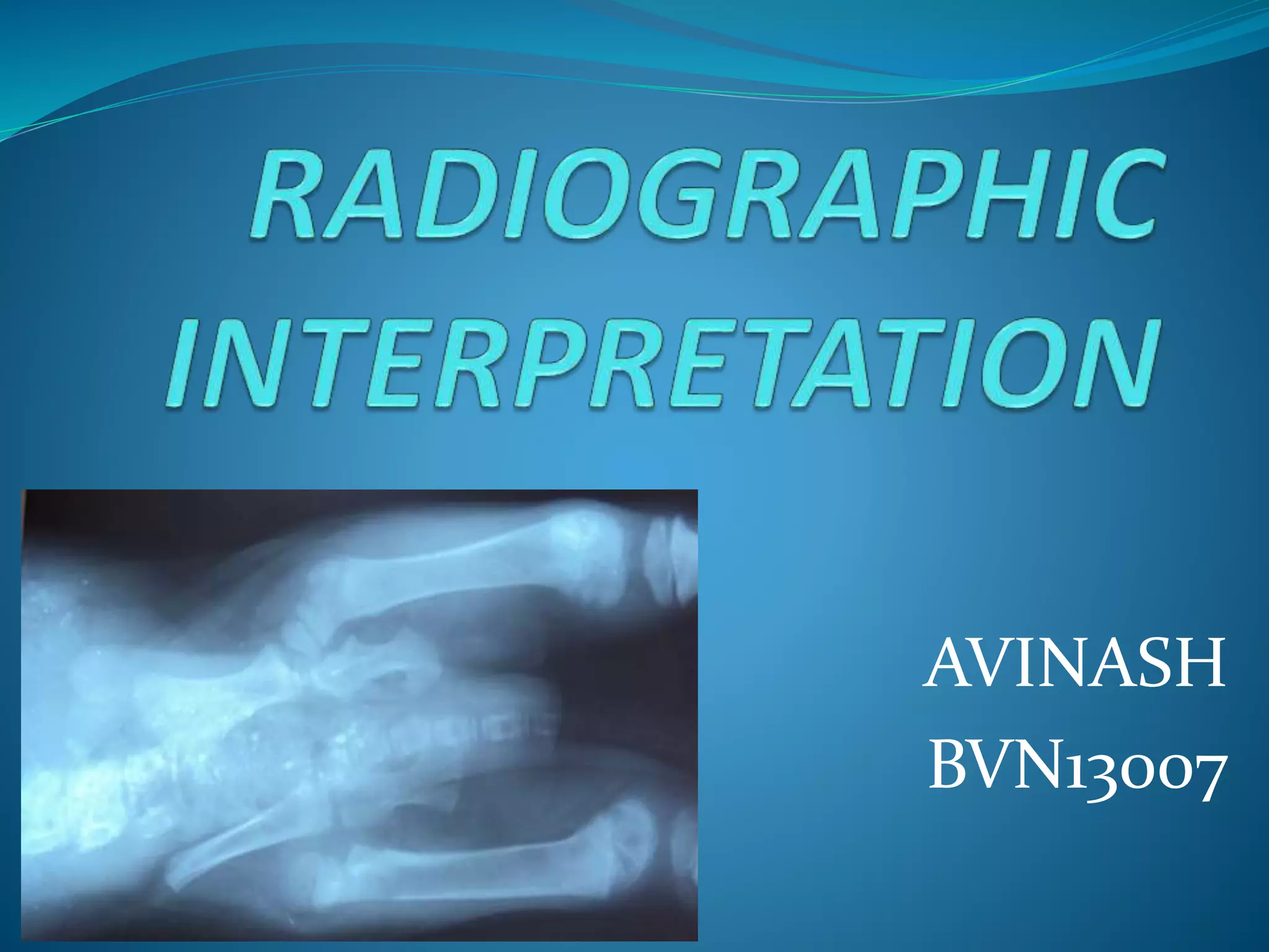Radiographic interpretation | PPTX
