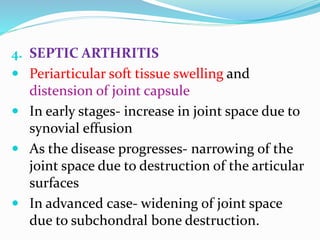 Radiographic interpretation | PPTX