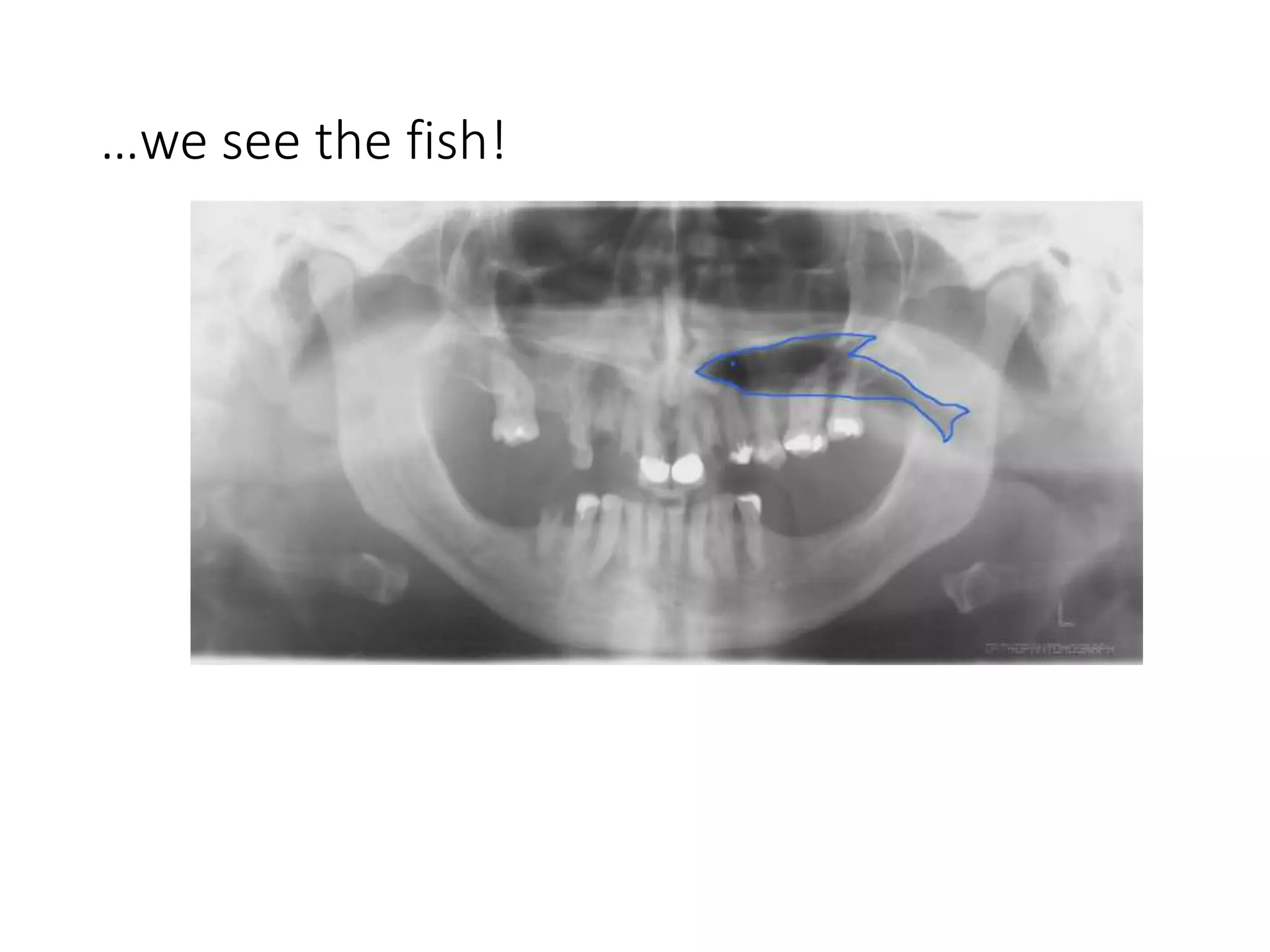 Radiographic interpretation | PPTX