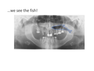Radiographic interpretation | PPTX