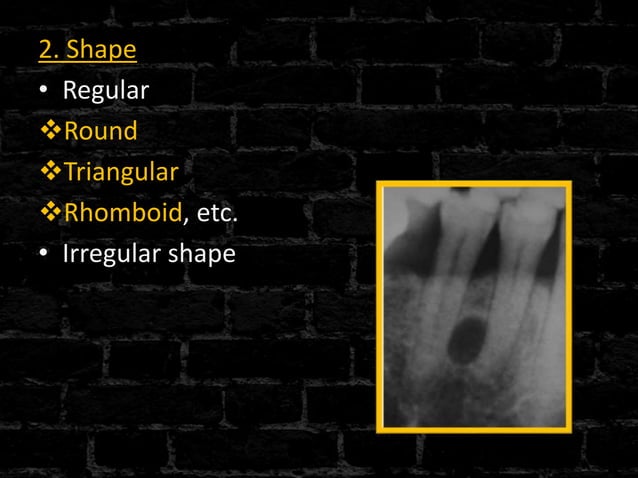 Radiographic interpretation of a lesion | PPTX | Dental Health ...