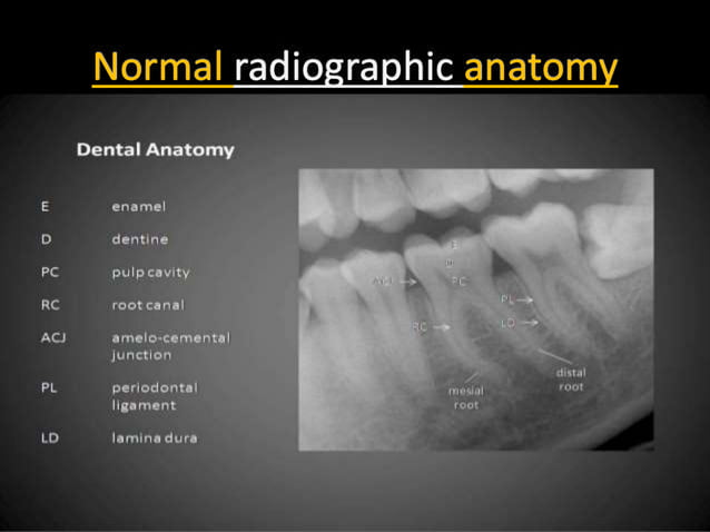 Radiographic interpretation of a lesion | PPTX | Dental Health ...