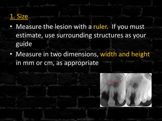 Radiographic interpretation of a lesion | PPTX
