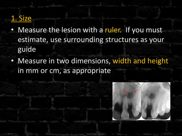 Radiographic interpretation of a lesion | PPTX | Dental Health ...