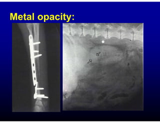 Radiographic interpretation.pdf | Medical Tests | Medical Health