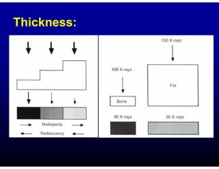 Radiographic interpretation.pdf | Medical Tests | Medical Health