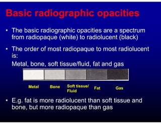 Radiographic interpretation.pdf | Medical Tests | Medical Health