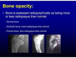 Radiographic interpretation.pdf | Medical Tests | Medical Health