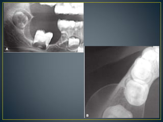 Radiographic interpretation (1).pptx