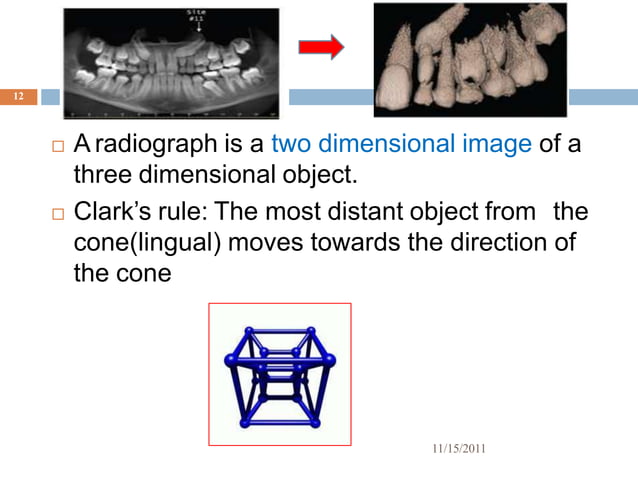 Radiographic Interpretation2.pptx