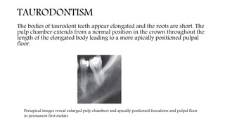 radiographic interpretations.pptx