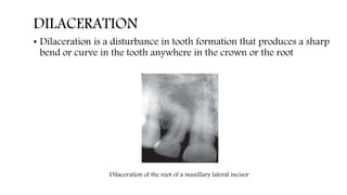 radiographic interpretations.pptx