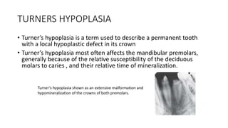 radiographic interpretations.pptx