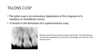 radiographic interpretations.pptx