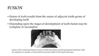 radiographic interpretations.pptx