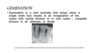 radiographic interpretations.pptx