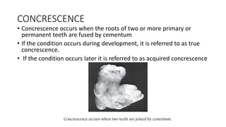 radiographic interpretations.pptx