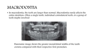 radiographic interpretations.pptx