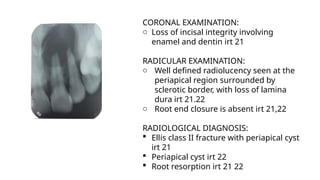 Radiographicity interpretations of iopar | PPTX