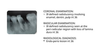 Radiographicity interpretations of iopar | PPTX