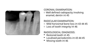 Radiographicity interpretations of iopar | PPTX