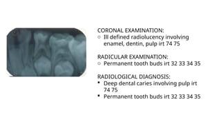 Radiographicity interpretations of iopar | PPTX