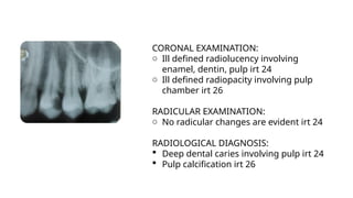 Radiographicity interpretations of iopar | PPTX