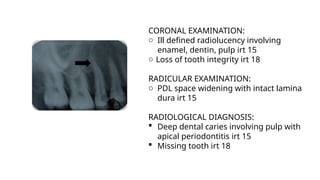 Radiographicity interpretations of iopar | PPTX