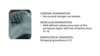 Radiographicity interpretations of iopar | PPTX