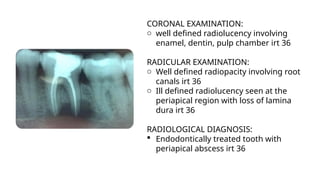 Radiographicity interpretations of iopar | PPTX