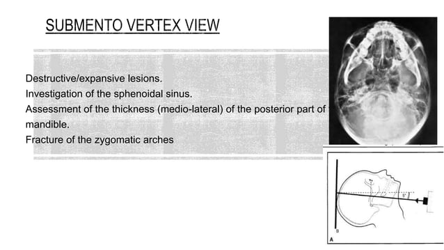 Radiographic investigations in oral and maxillofacial surgery | PPTX