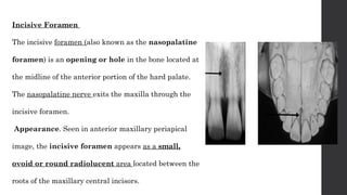 radiographic landmarks of maxilla and mandible | PPTX