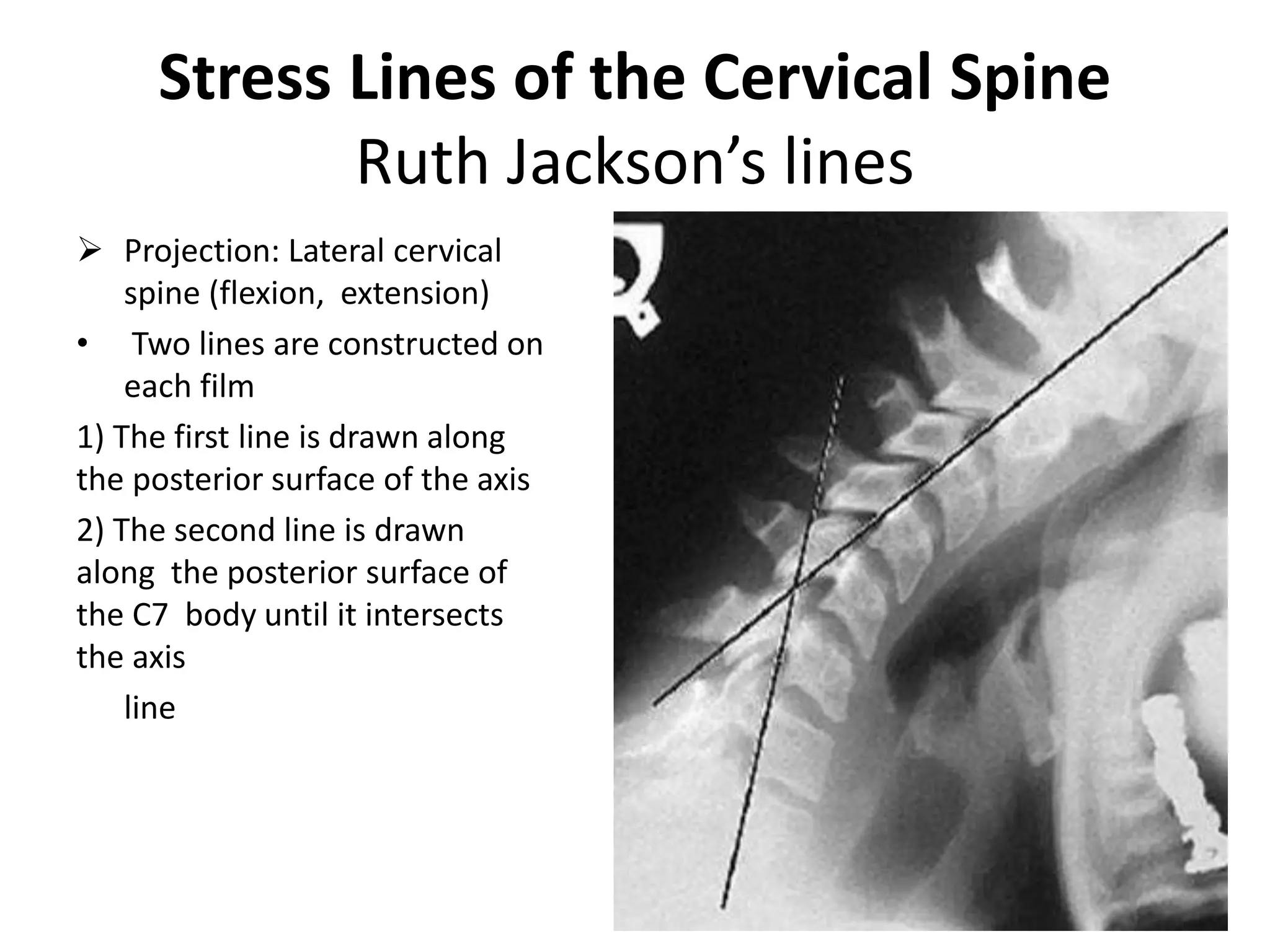 Radiographic lines and angles | PPTX