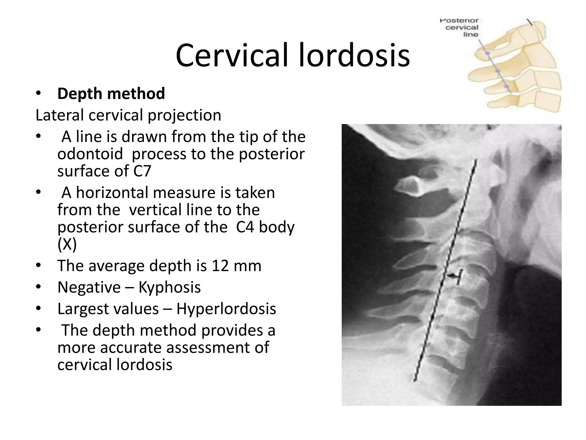 Radiographic lines and angles | PPTX
